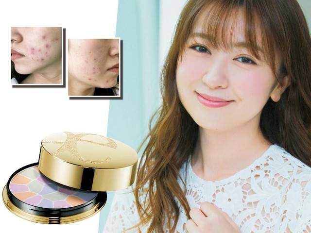 大人ニキビからの脱却ストーリー・美肌女子のスキンケア（MAQUIA ONLINE）